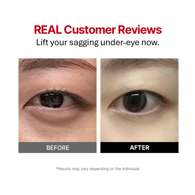 Wrinkle-fit Tangle Eye Cream – MEDITHERAPY