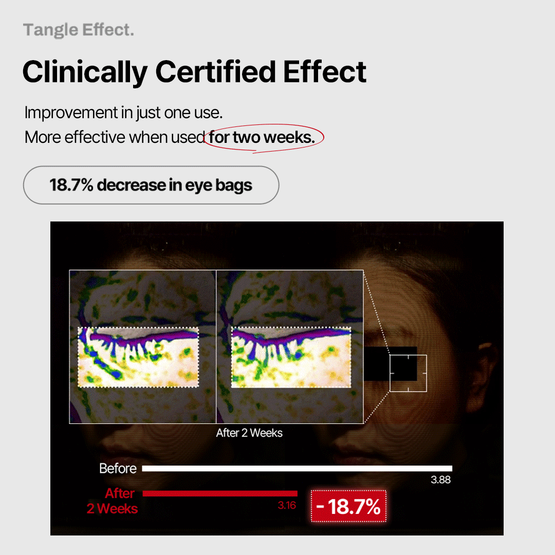 Wrinkle-fit Tangle Eye Cream – MEDITHERAPY